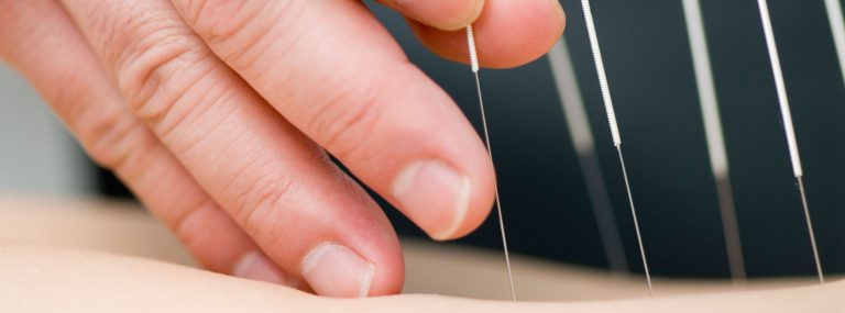 Nada Acudetox UK - Workshops & Support Acupuncture Detoxification